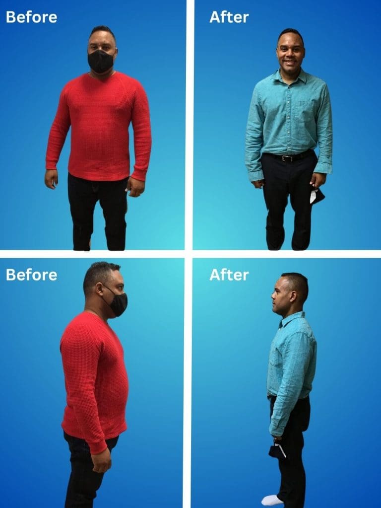 Semaglutide Weight Loss Orlando 407 804 5200